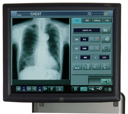 Overview Of The Fuji CR Systems | It's a Benvie World