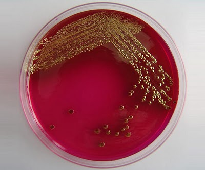 SimpleCiência.com: KPC a bactéria comum que tornou-se resistente