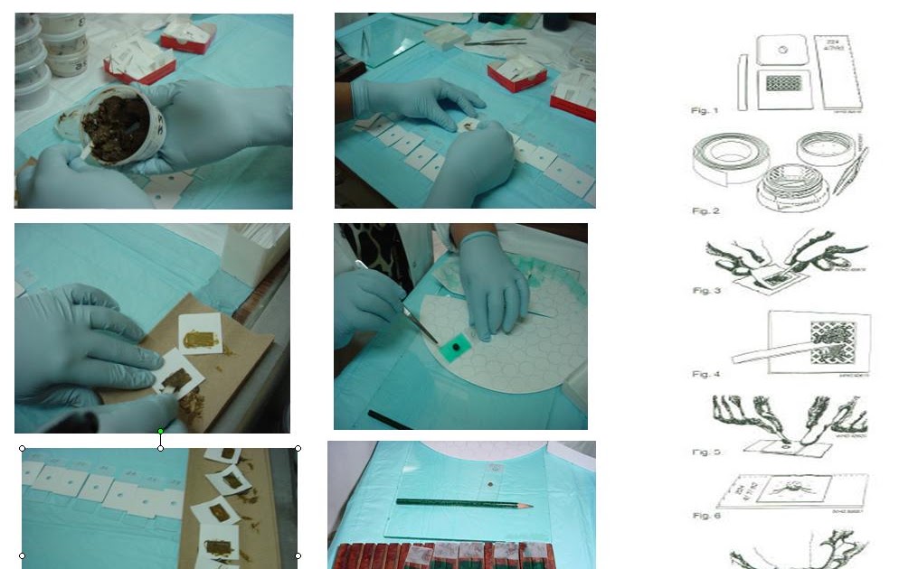 Método De Kato Katz - BRAINCP