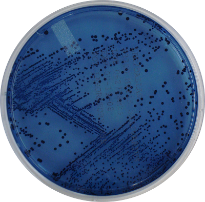 Microbiology: Mitis Salivarius Agar