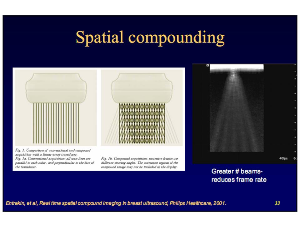 BÀI SOẠN VỀ SIÊU ÂM CHẨN ĐOÁN: SIÊU ÂM ĐA HƯỚNG / Spatial Compound ...