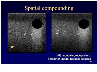 BÀI SOẠN VỀ SIÊU ÂM CHẨN ĐOÁN: SIÊU ÂM ĐA HƯỚNG / Spatial Compound ...