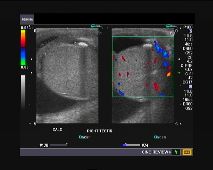 cochinblogs: November 2006