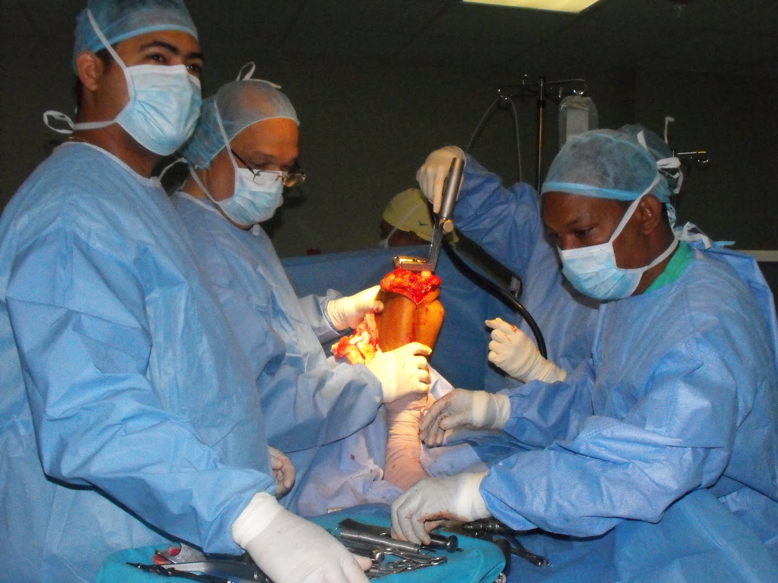 CIRUJANOS ORTOPEDAS DEL HOSPITAL DOCTOR NEY ARIAS LORA REALIZAN ...