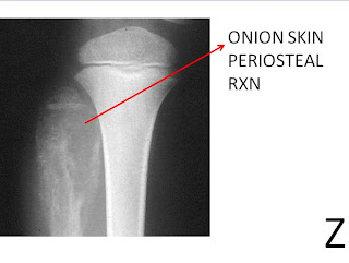 the power of sharing: x-rays