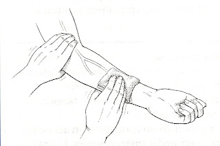 Guía de salud: HEMORRAGIA GRAVE