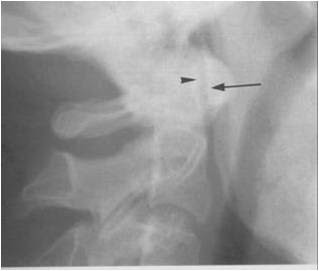 Pattern recognition in Diagnostic Radiography