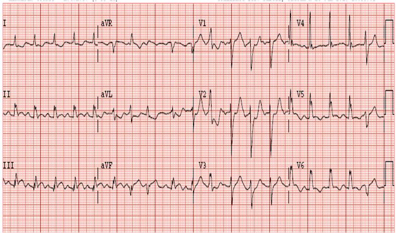 Living 4 Zachary: Know the facts about Sudden Cardiac Awareness