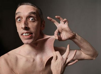 Elastic Man: Garry Turner Sets Stretchiest Skin Record | Strange ...