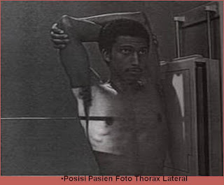 Teknik Pemeriksaan Radiografi Thorax Proyeksi PA - Seputar Kesehatan