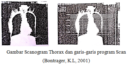 blog dedhe: pemeriksaan diagnostik pada neurobehavior