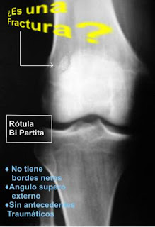 UNT PRACTICOS DE TRAUMATOLOGÍA: Practico de Rodilla