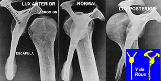 UNT PRACTICOS DE TRAUMATOLOGÍA: Práctico de Hombro