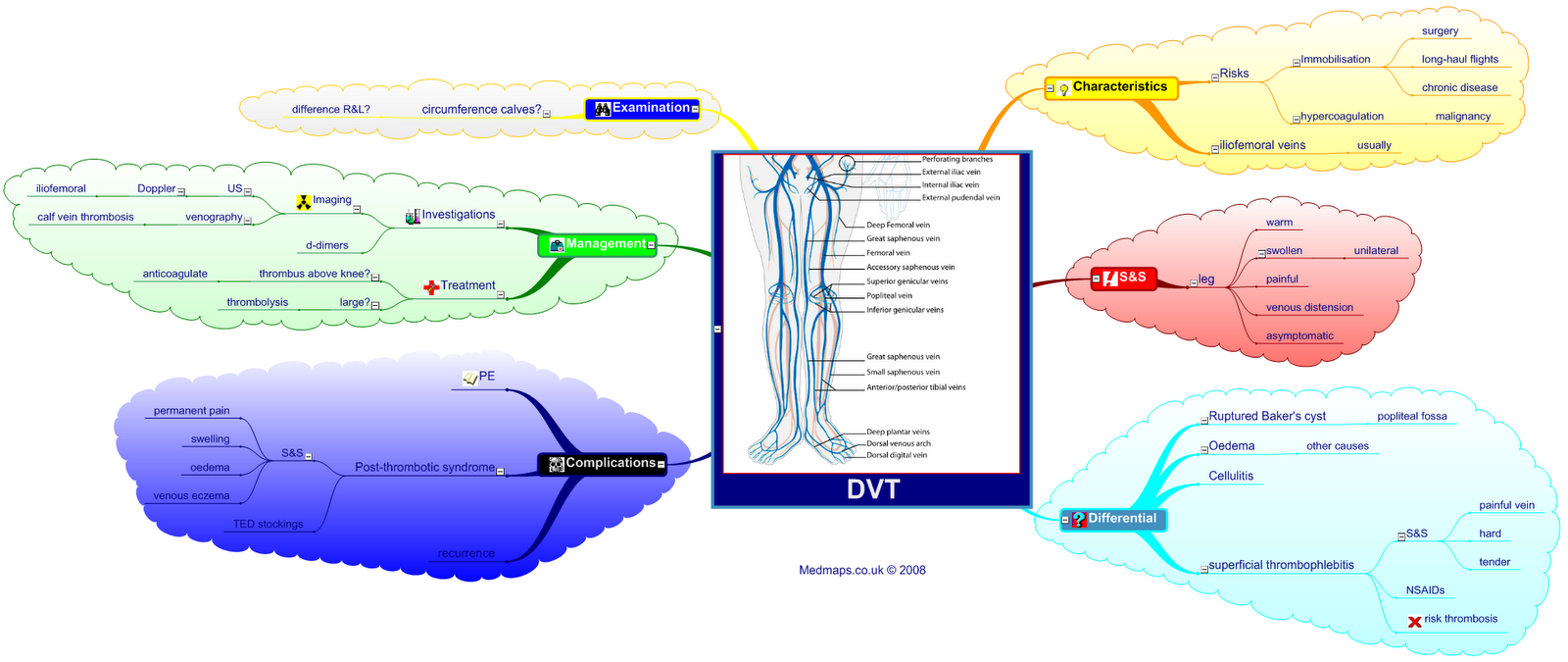Mind map of DVT