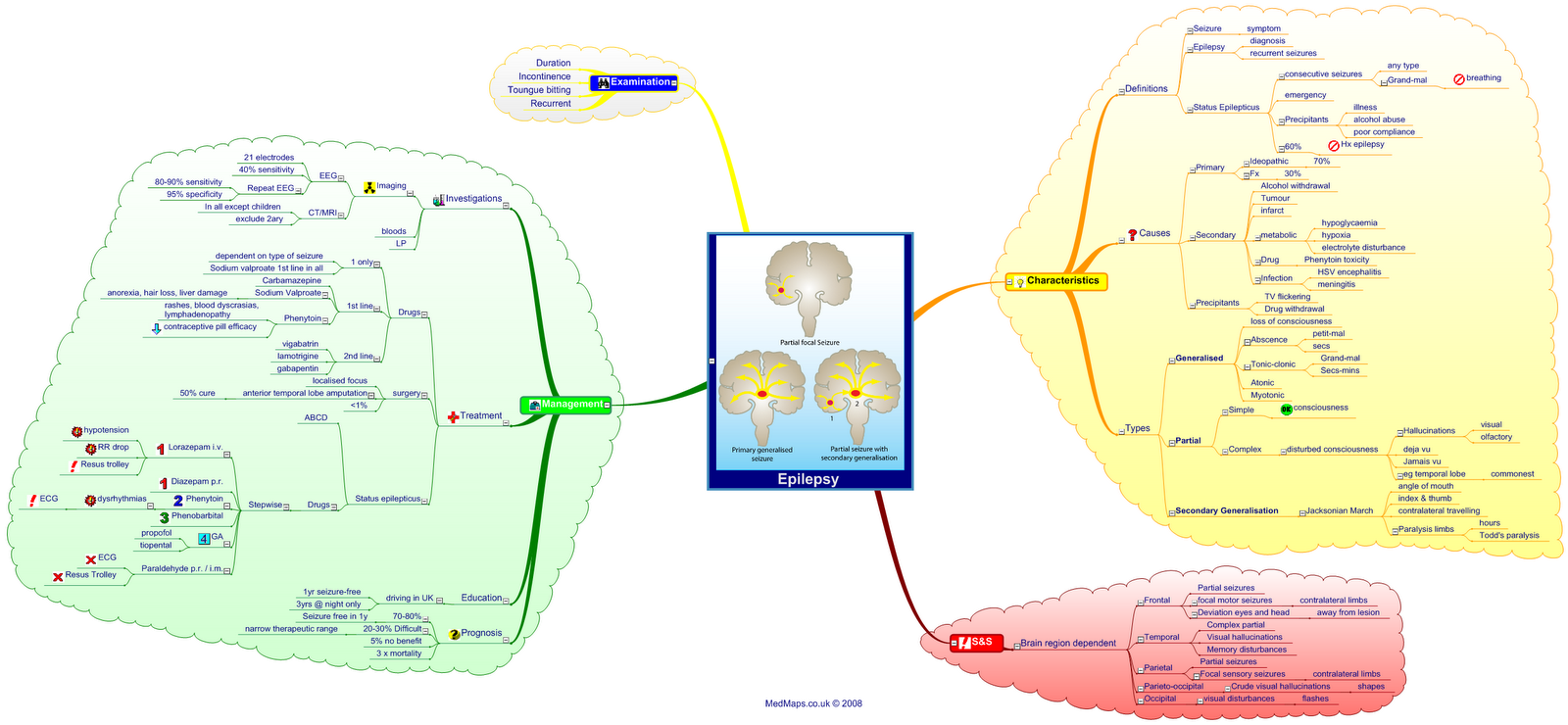Mind map of Epilepsy