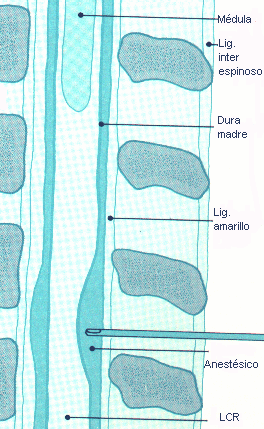 elanestesiologo | A fine WordPress.com site