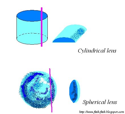 Cylindrical Lens Vs Spherical Lens