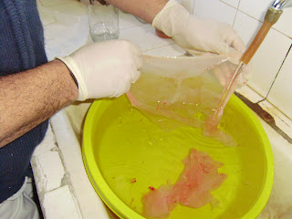 Orthophaedic and Traumatology Surgery.: UNO DE LOS ACTORES PRINCIPALES ...