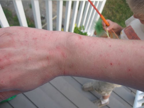 Black Raspberry Season! | Swistle