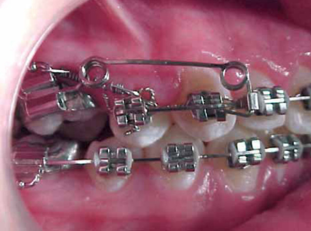 Ortodoncia Santo Domingo República Dominicana