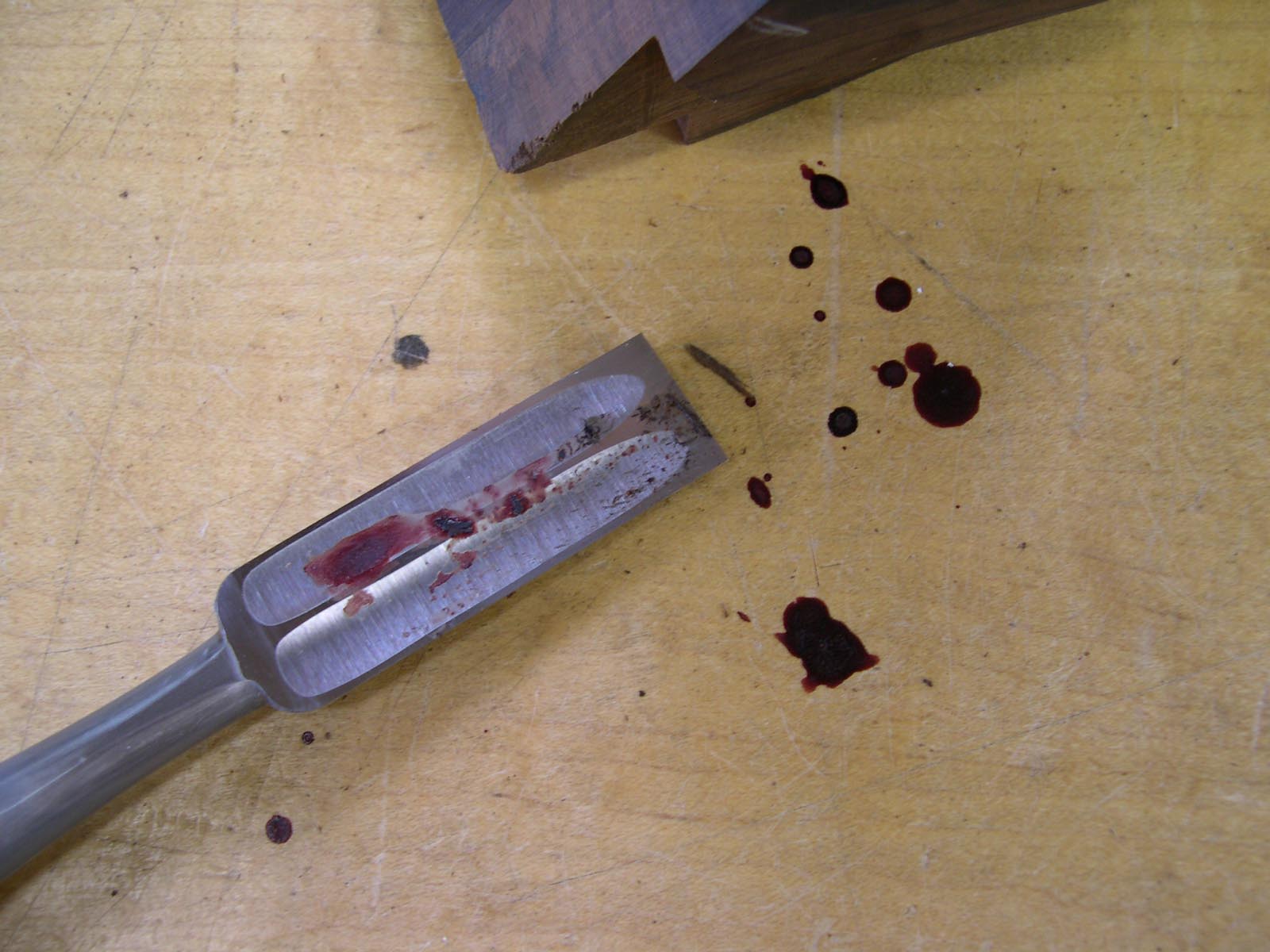 Sauer & Steiner: My first real injury