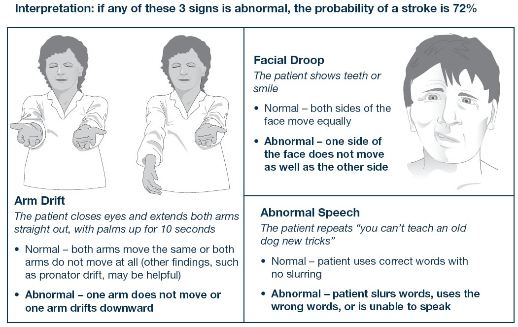 Cincinnati Stroke Scale ~ medik-ukm
