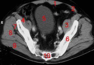 RadiologySpirit: HOW TO READ CT ABDOMEN