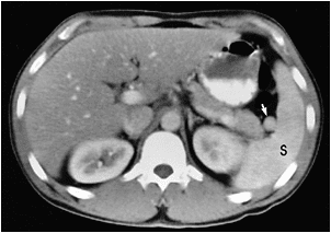 RadiologySpirit: 2010-04-11