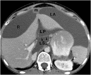 RadiologySpirit: 2010-04-25