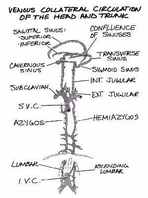 Superior Vena Cava Syndrome Collateral Circulation