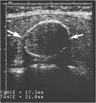 RadiologySpirit: 2010-06-20