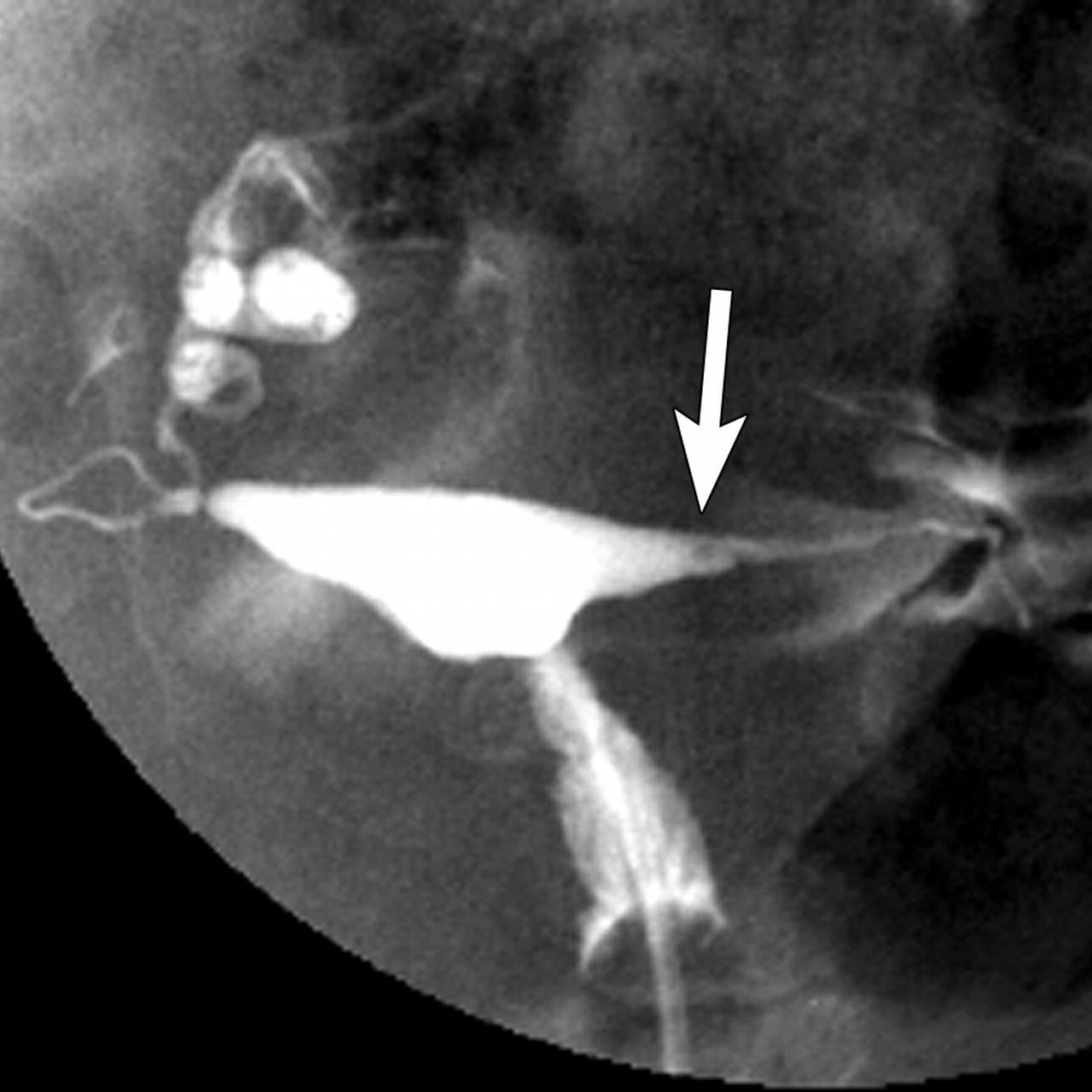 RadiologySpirit: 2010-06-27