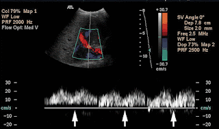 RadiologySpirit: 2010-07-18
