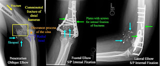 RadiologySpirit: 2010-07-25
