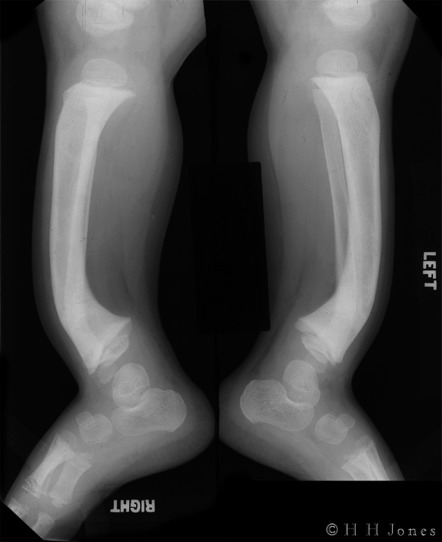 RadiologySpirit: 2010-08-15