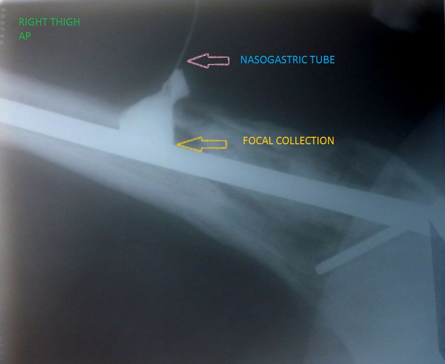 RadiologySpirit: sinogram