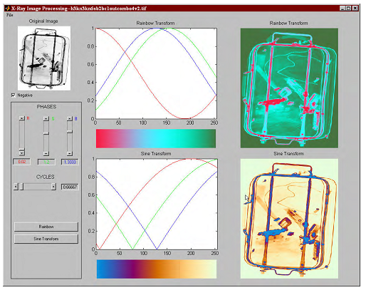 Xray Imaging using Pseudo coloring Matlab | Matlab Projects.....