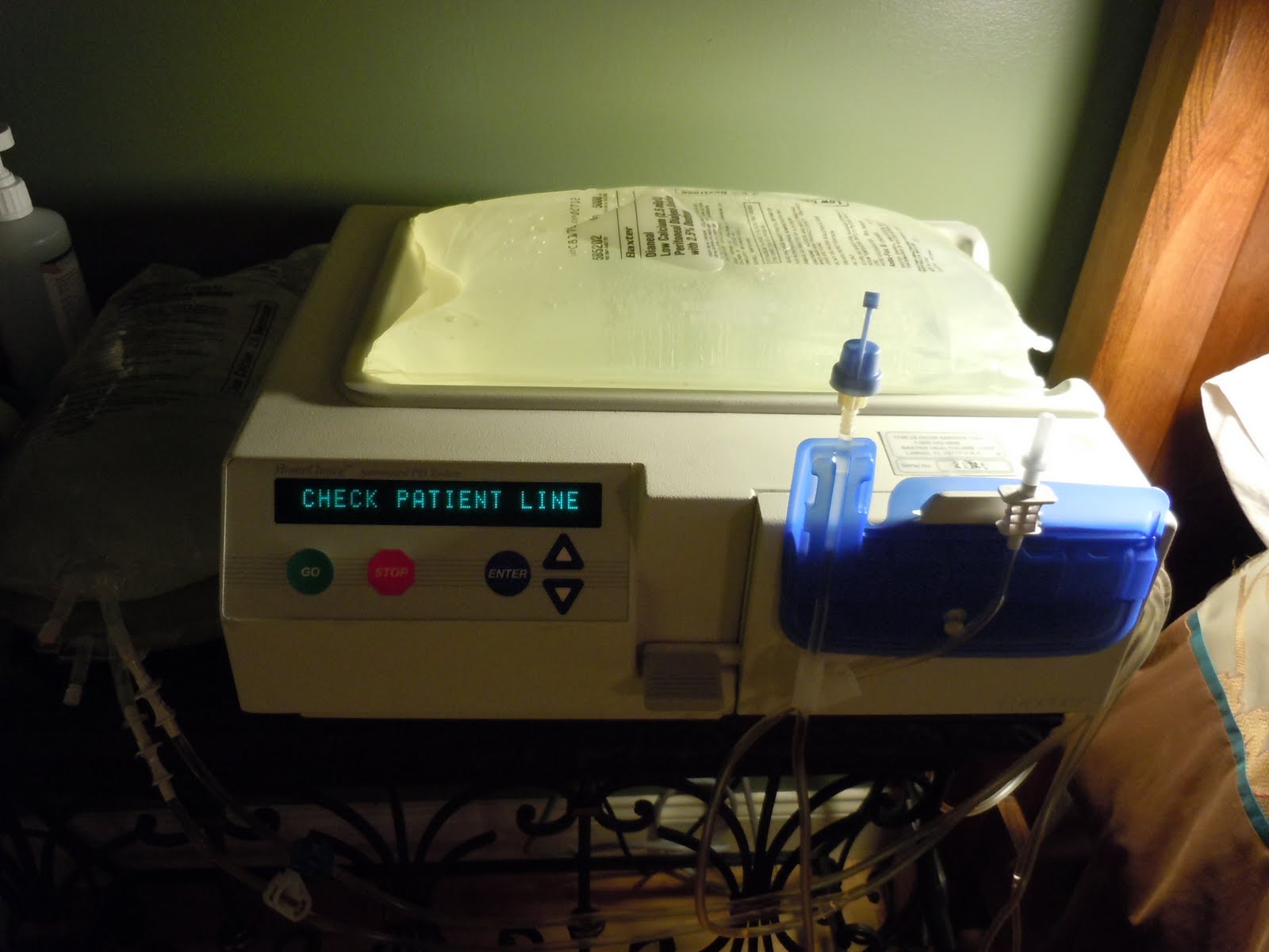 Kidneys NOT Included........requires 1-2 O+ renal organs: Bye Bye Baxter