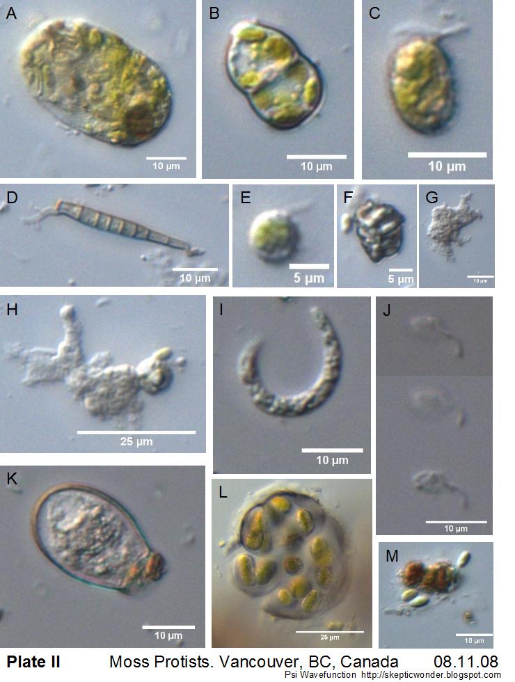 Body Painting: protists in pond water