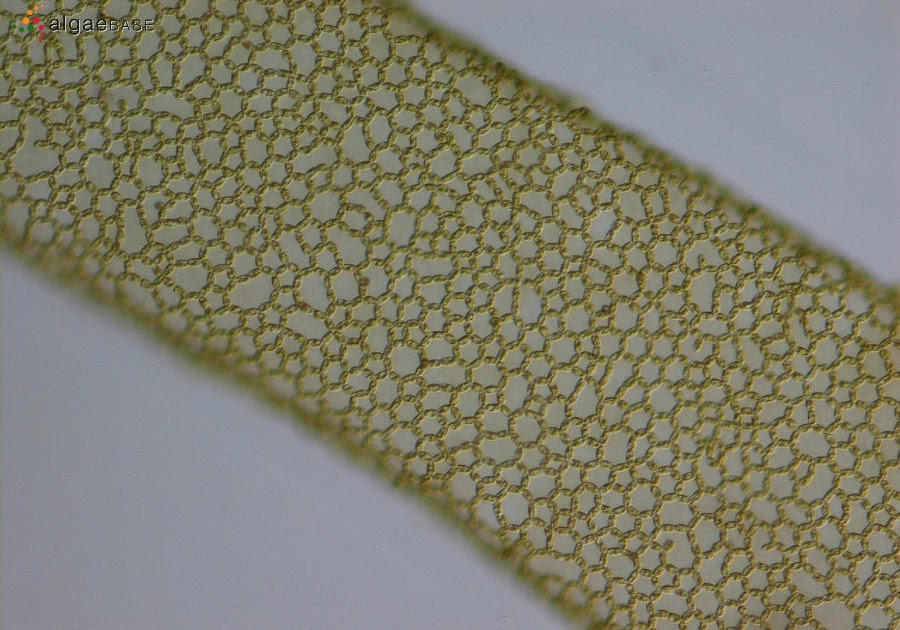 Skeptic Wonder: Sunday Protist -- Hydrodictyon: The water net