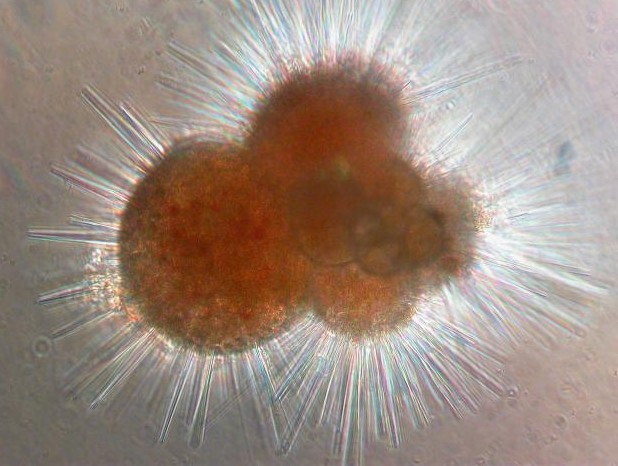 Skeptic Wonder: Sunday Protist - Assorted forams