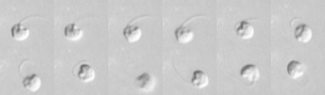 Skeptic Wonder: Deciphering protist shapes