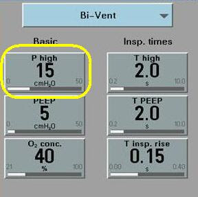 FREMITUS: What is p-High?