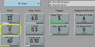 FREMITUS: What is p-Low?: APRV terminology.