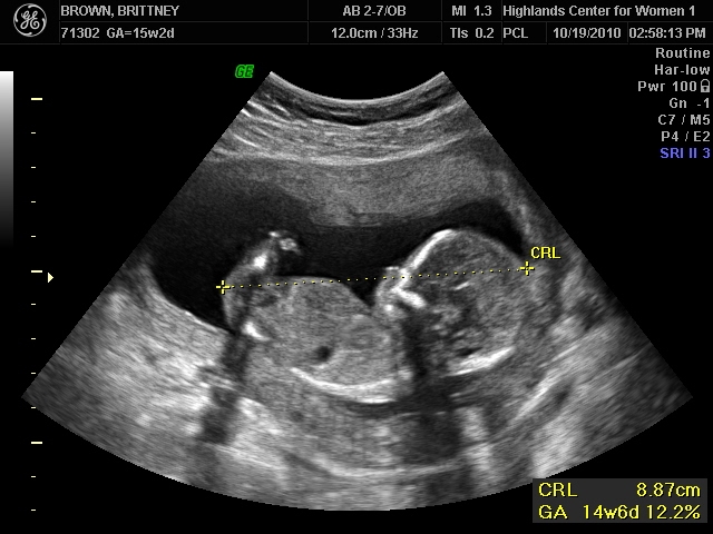Tanner Wesley Brown 4-10-11: 15 Week Ultrasound