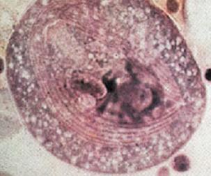 Goldfish Care - Types | Pictures | Diseases and Treatment: Chilodonella