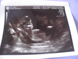 salohome.com: 13 weeks, first ultrasound!
