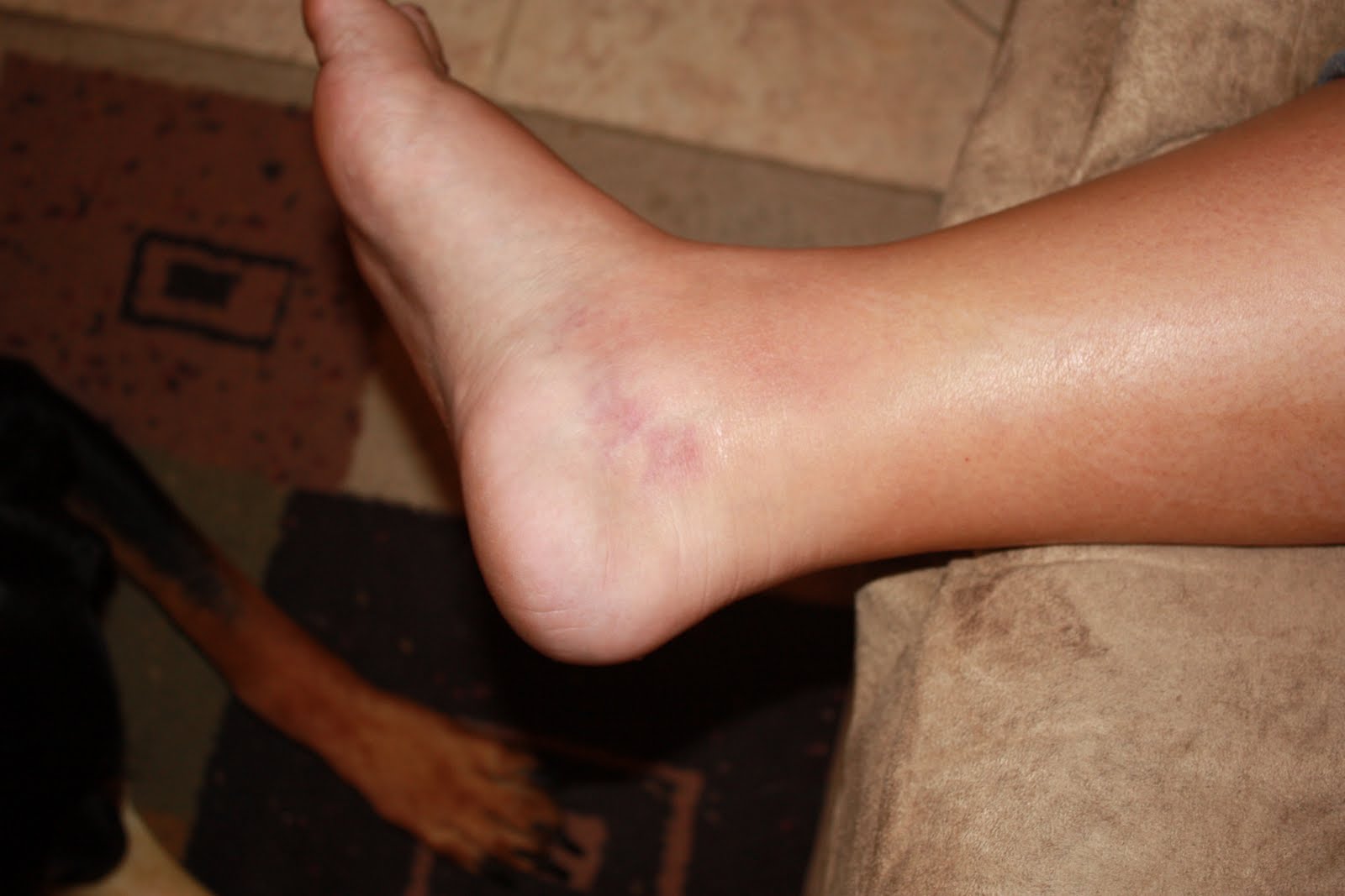 Waterlogged, Sore, Blistered and Loving It!: Ankle Update