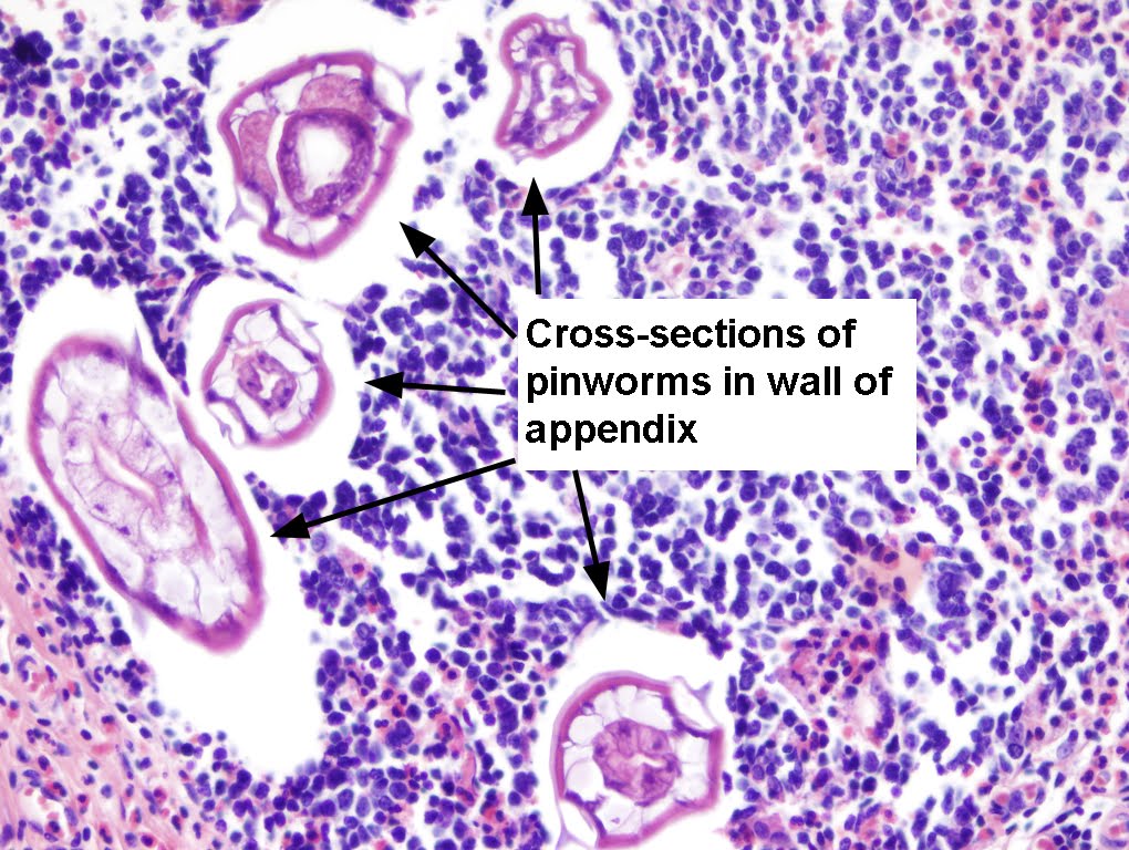 Creepy Dreadful Wonderful Parasites: 2010