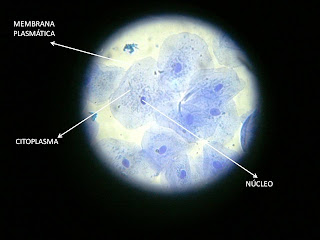 BIOLOGÍA HUMANA (IES PUNTA LARGA): TEJIDO EPITELIAL DE LA MUCOSA BUCAL